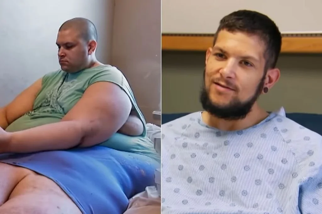 Como está J.T.? Participante de "Quilos Mortais" pesava mais de 400 kg e tinha grave problema na ...