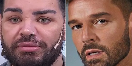 Argentino realiza 30 cirurgias plásticas para parecer com Ricky Martin ...