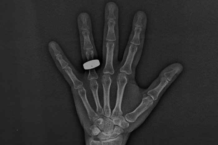 Radiologia ajuda no diagnóstico com interpretação de imagens; saiba ...