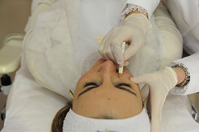 Entenda Qual O Seu Tipo De Olheira E Saiba Como Tratar Donna