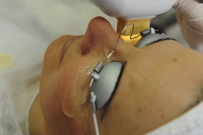 Entenda Qual O Seu Tipo De Olheira E Saiba Como Tratar Donna